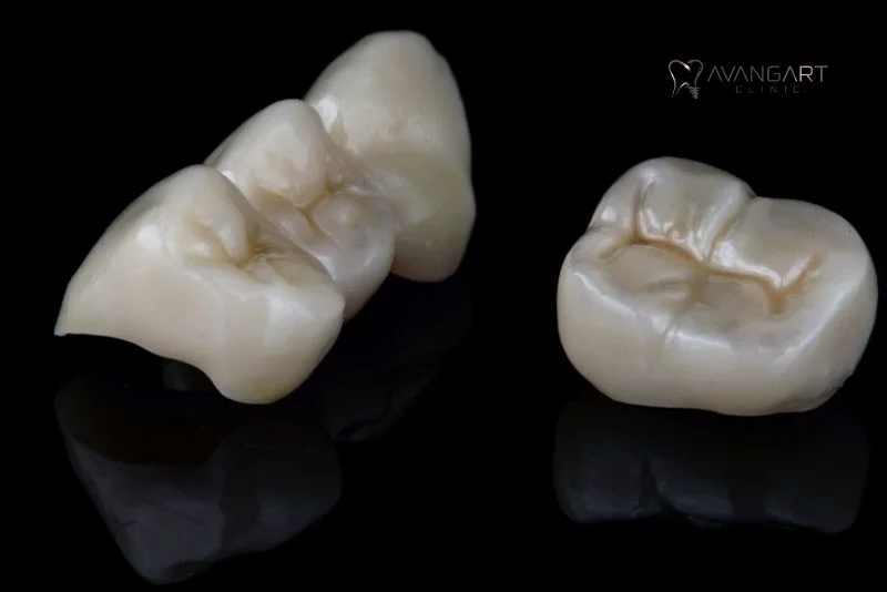 Zirconium Crowns Turkey Cost and Benefits