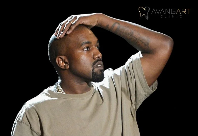 Kanye West New Teeth: The $850K Kanye Titanium Dentures